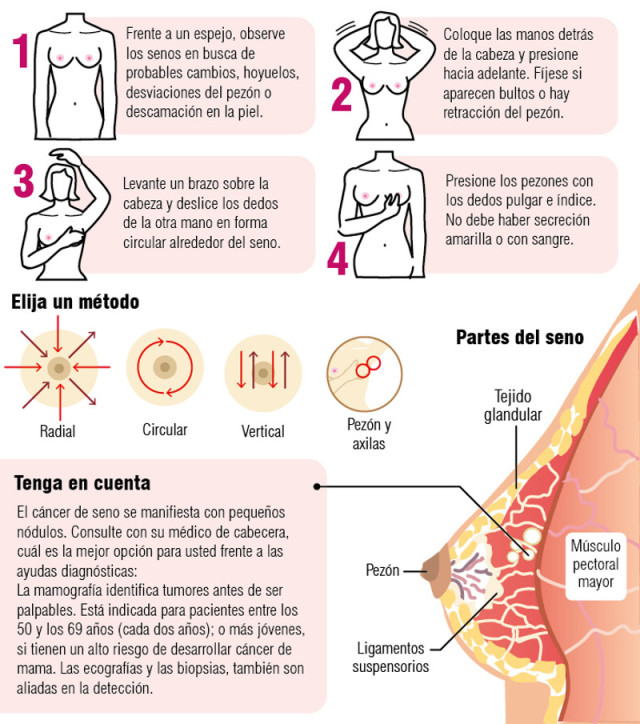 En Cáncer De Mama El Diagnóstico Temprano Es Determinante Hágase El